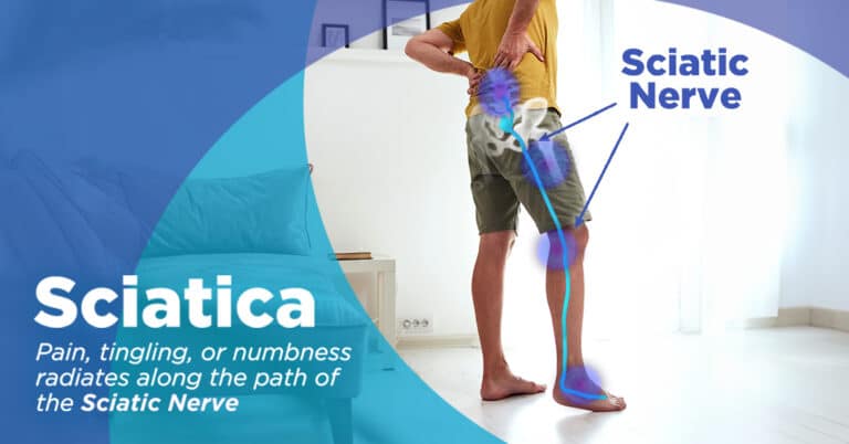 Physical Therapy Exercises for Sciatica - Confluent Health